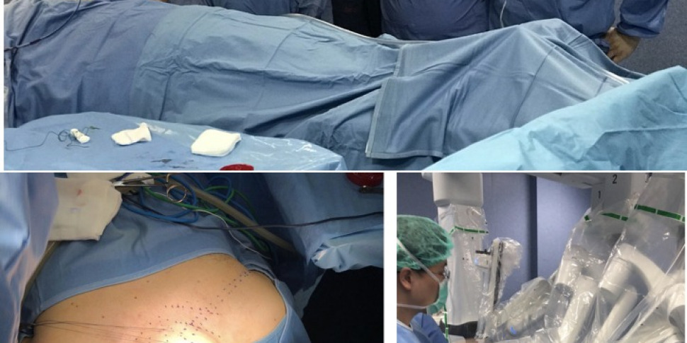 A Messina la prima tiroidectomia transorale robotica in Europa ...