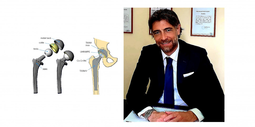 Protesi d'anca, da Messina uno sguardo nel futuro - Gazzetta del Sud