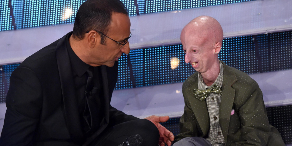 La morte di Sammy Basso: cos'e' la Progeria di Hutchinson-Gilford ...