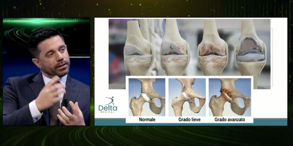 Agenda BenEssere, l'artrosi degli arti inferiori: se ne parla col dott ...